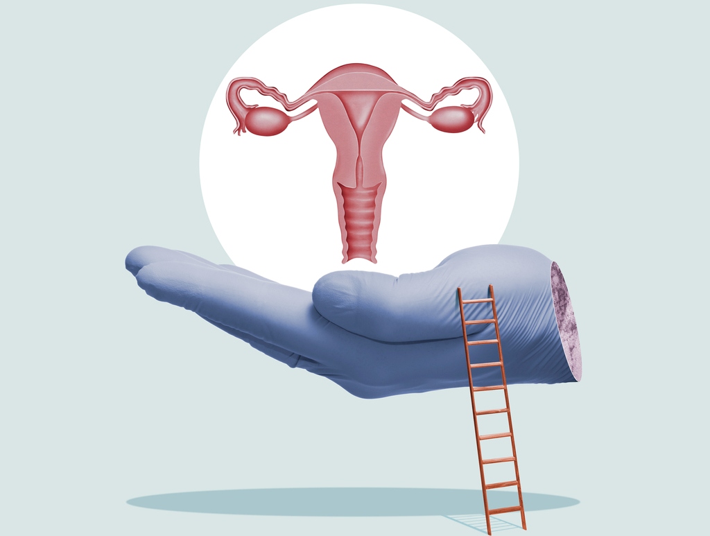 Transplantul de uter in România? Cazuri, costuri și riscuri - Naste natural