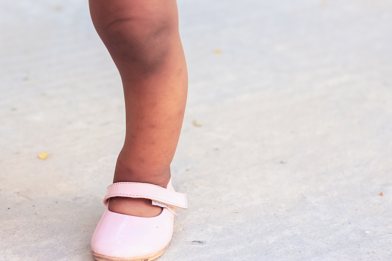 Rahitismul carențial: ghid despre simptome și tratament - Naste natural